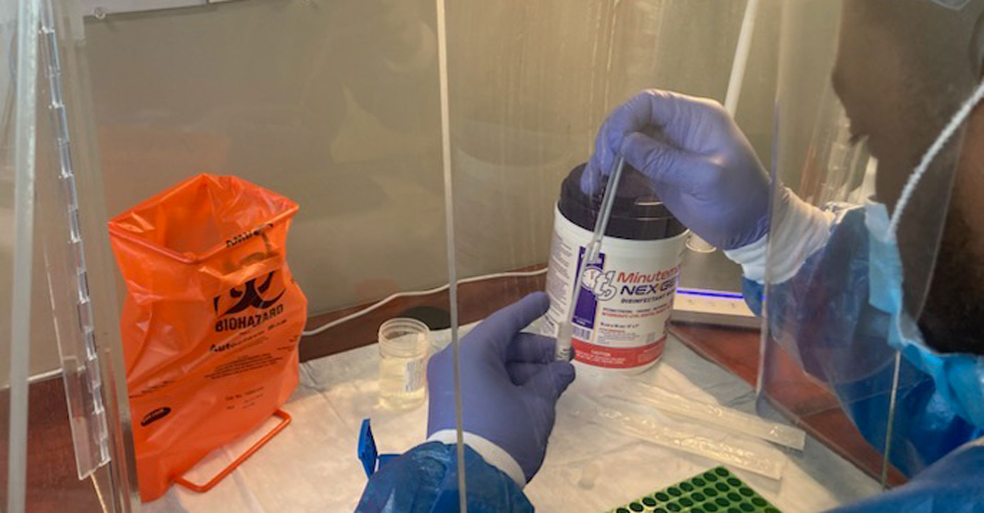 GeneXpert testing “game changer” for respiratory infection diagnosis in ...